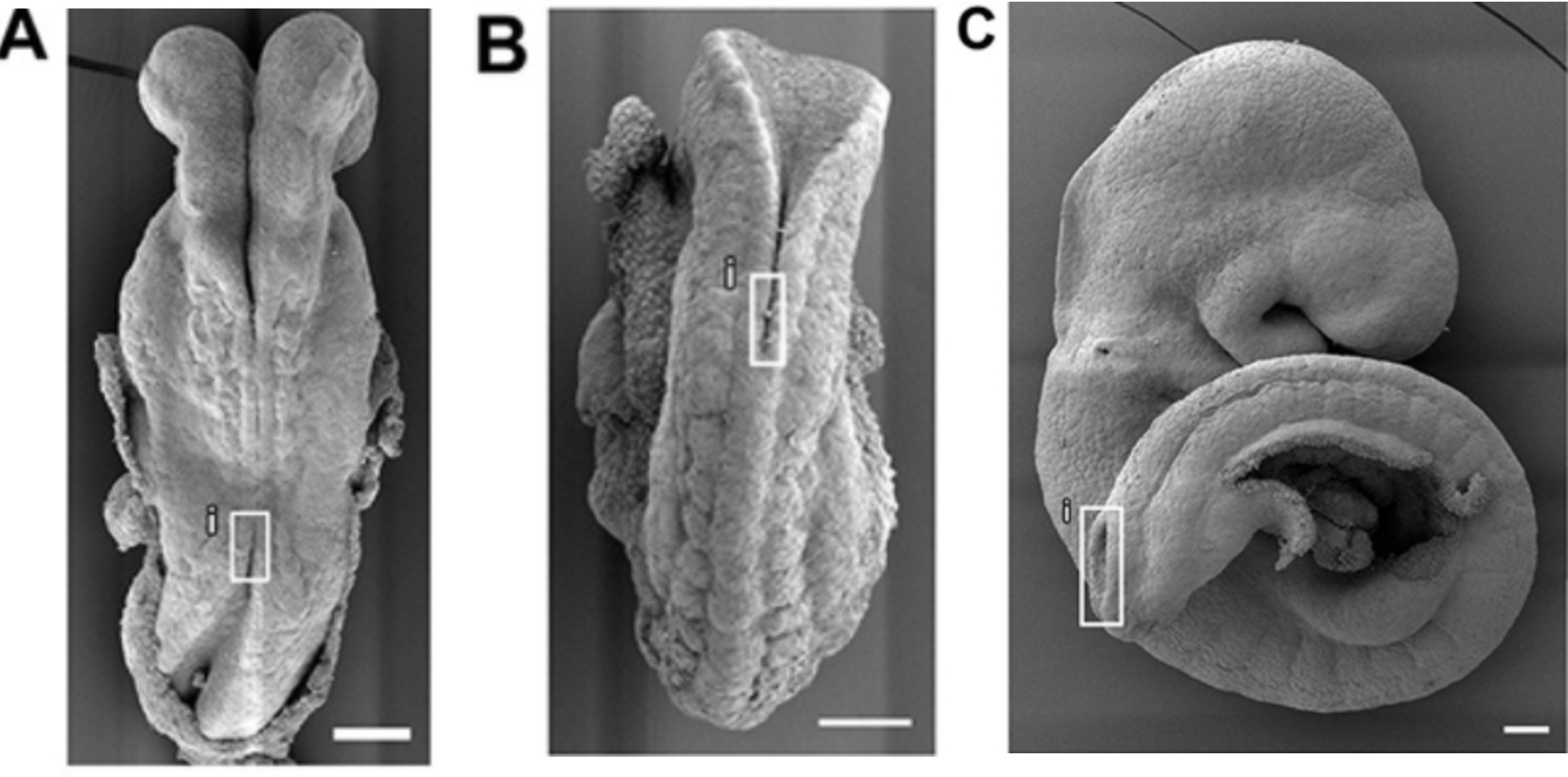 La neurulation – Biologie cellulaire et génétique du Développement