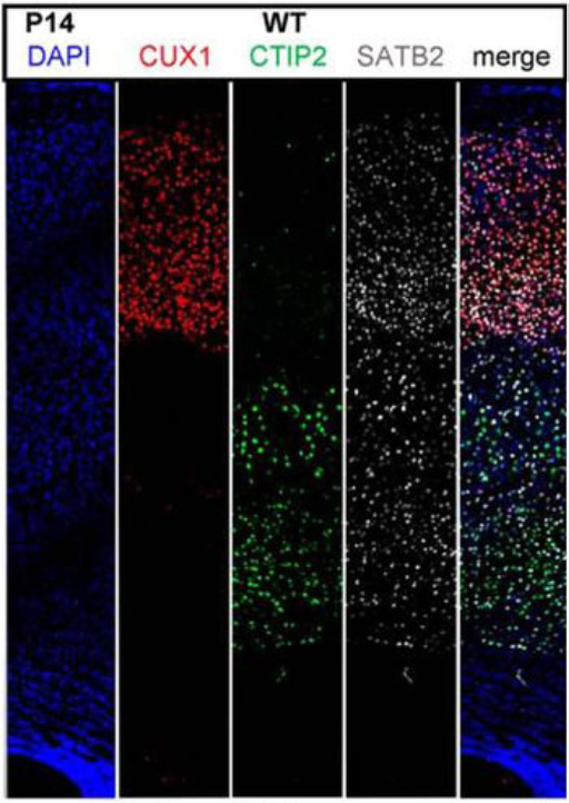 Le développement du cortex – Biologie cellulaire et génétique du ...